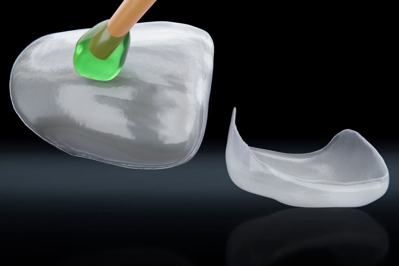 Emax veneers Turkey costs - Emax porcelain crown Istanbul review