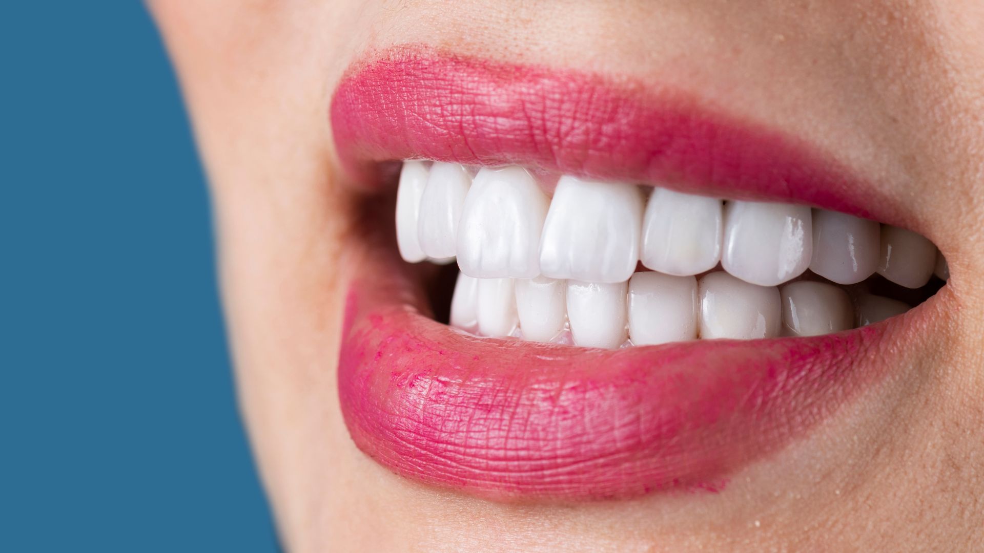 Zirconium Crowns Istanbul, Turkey: Cost, Benefit, Before&After