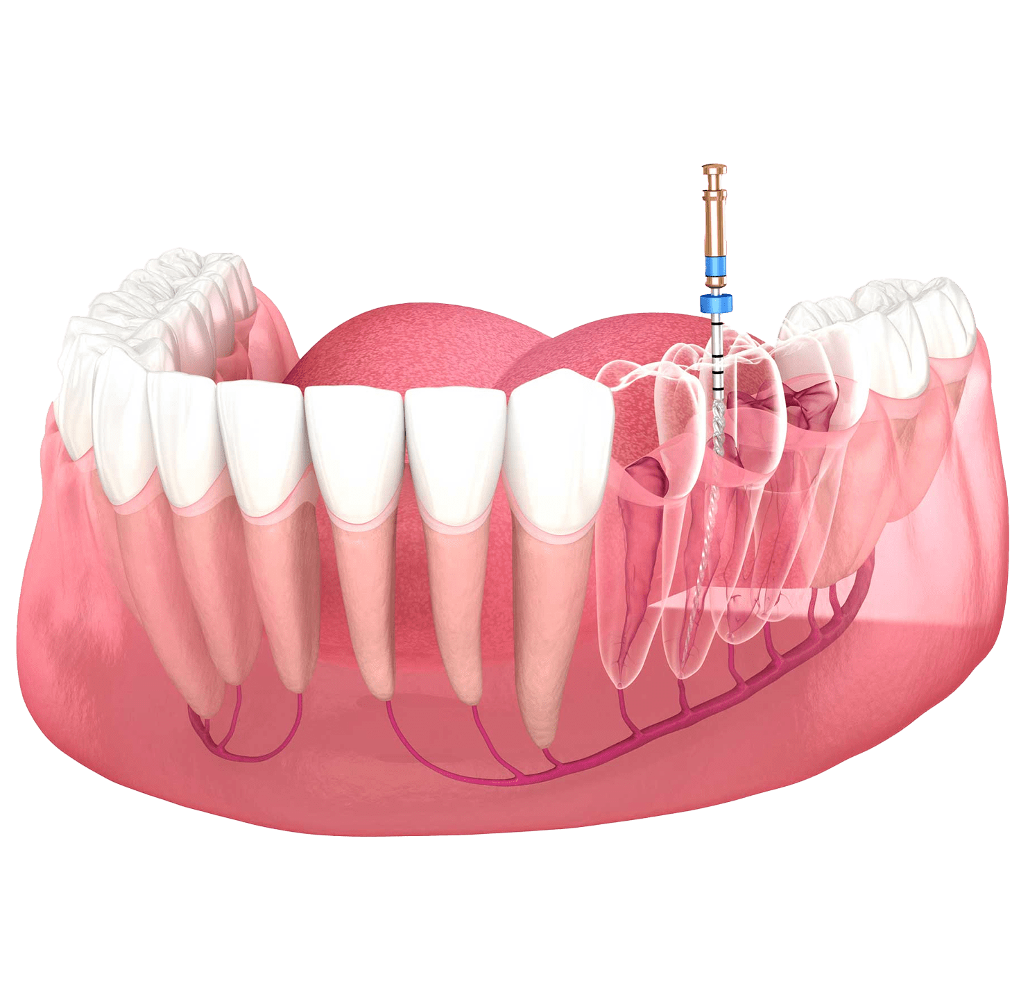 Kanal Tedavisi Endodonti - Çok Seanslı Tedavi Fiyatları | Kadıköy